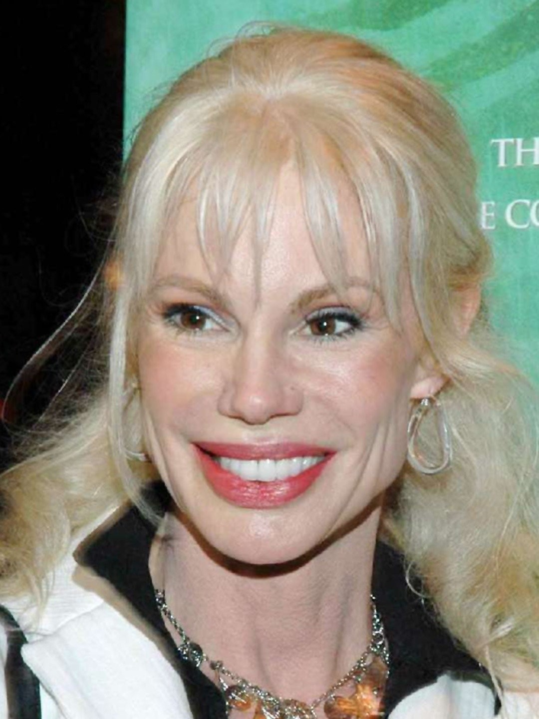 Bree Walker Plastic Surgery Gone Wrong Before And After