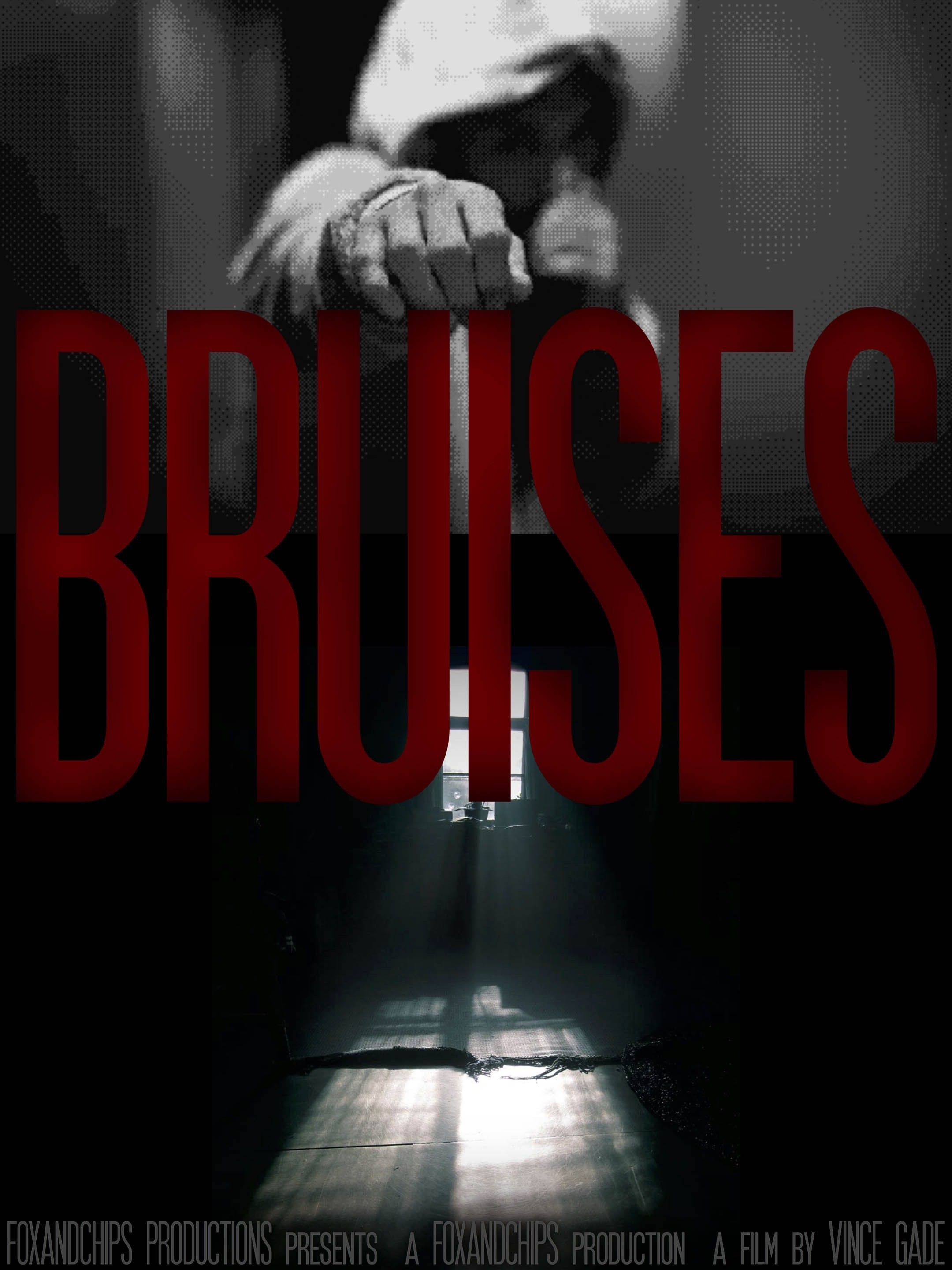 Bruises Pictures | Rotten Tomatoes