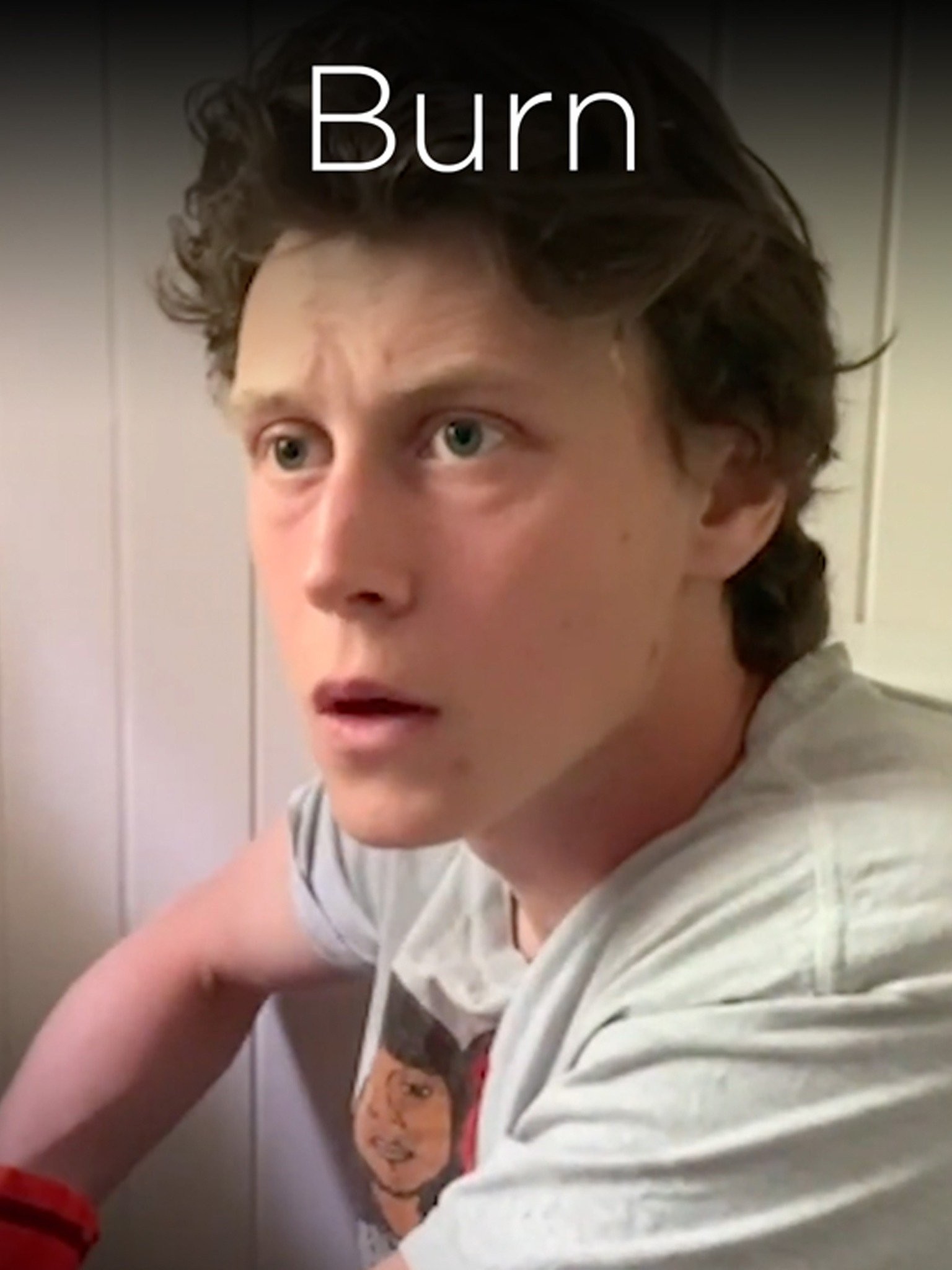 Burn Pictures | Rotten Tomatoes