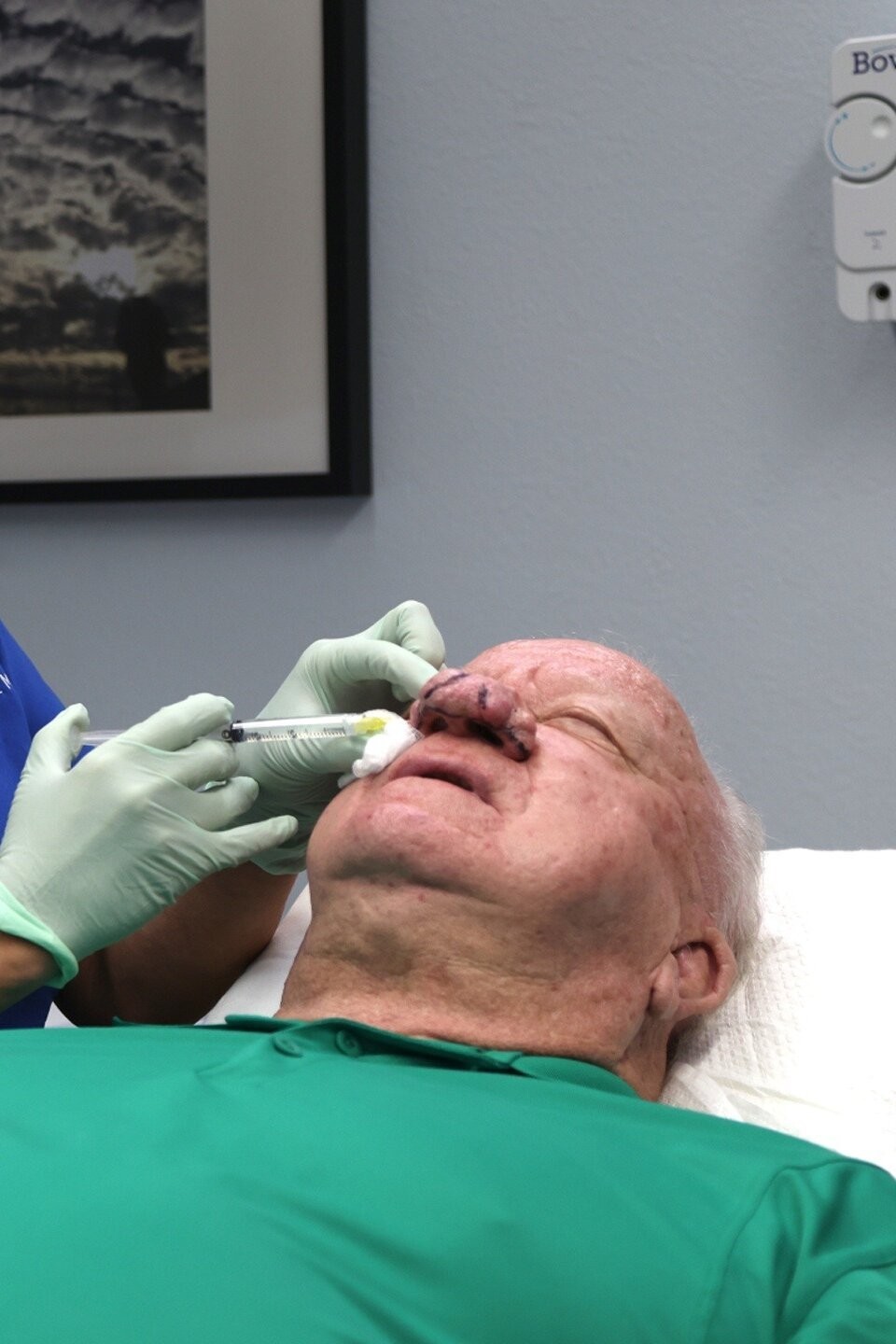 Plum Nose Pictures - Rotten Tomatoes