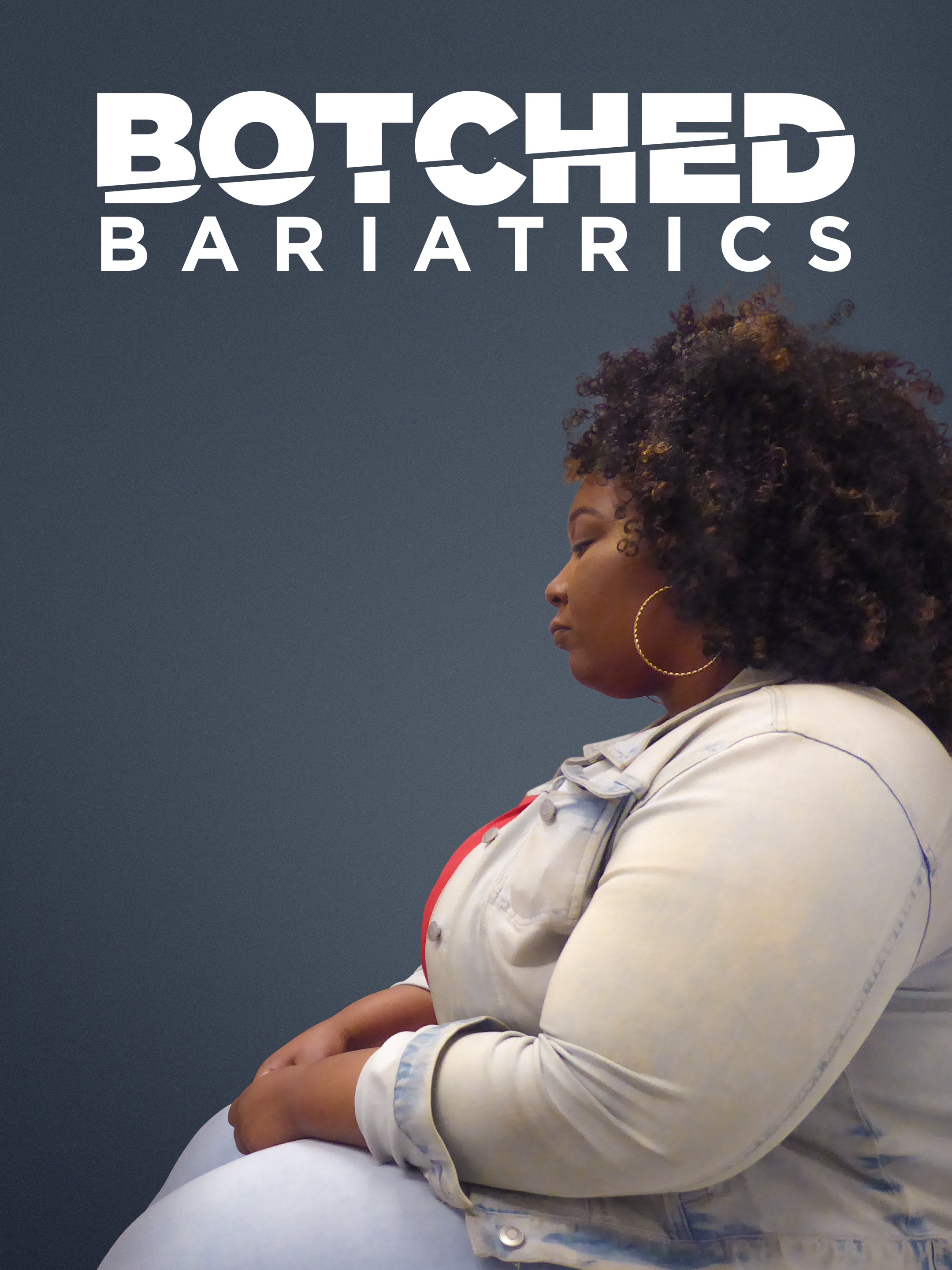 Botched Bariatrics Pictures | Rotten Tomatoes