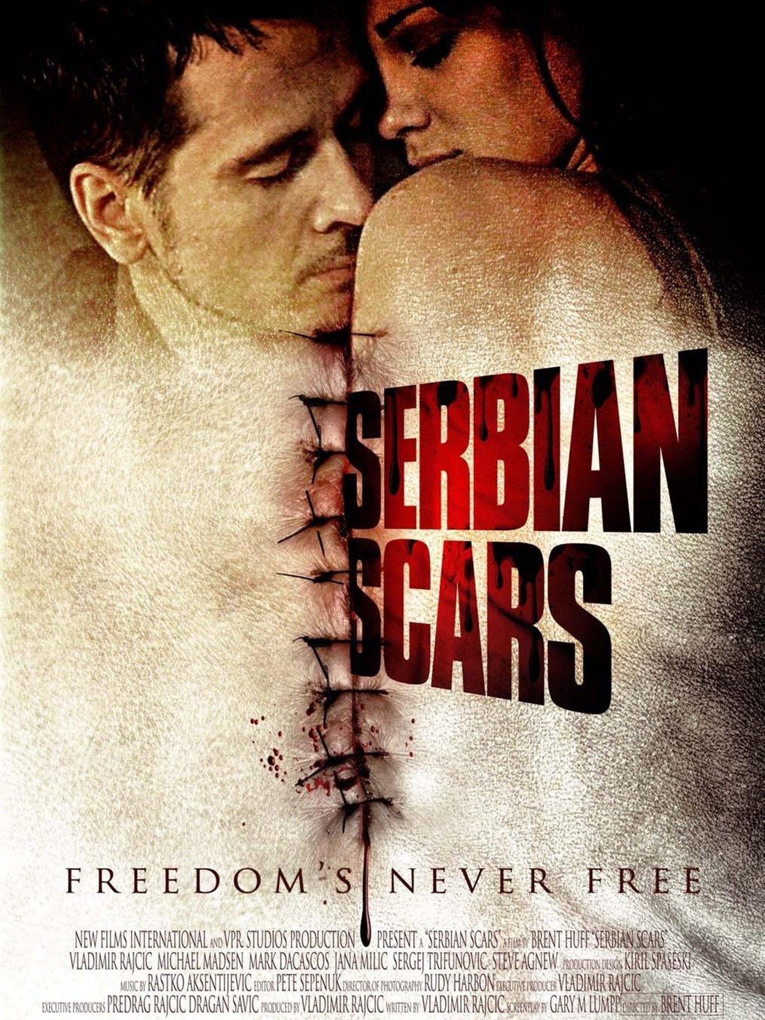 Serbian Scars Pictures | Rotten Tomatoes