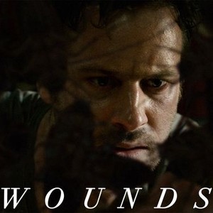 Wounds - Rotten Tomatoes