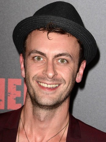 Joseph Gilgun Teeth