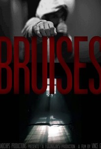 Bruises | Rotten Tomatoes