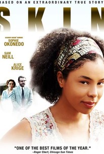 Skin | Rotten Tomatoes