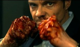 Novocaine - Trailers & Videos | Rotten Tomatoes