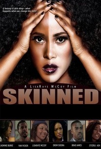 Skinned | Rotten Tomatoes