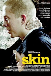 Skin (2008) | Rotten Tomatoes