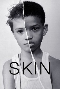 Skin (2018) | Rotten Tomatoes
