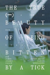The True Beauty of Being Bitten by a Tick | Rotten Tomatoes