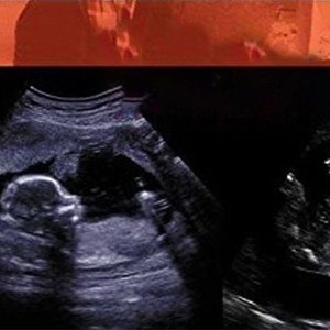 Double Daddy (2015) - Rotten Tomatoes