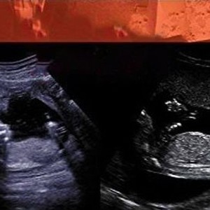 Double Daddy (2015) - Rotten Tomatoes