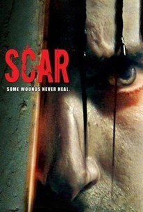 Scar | Rotten Tomatoes