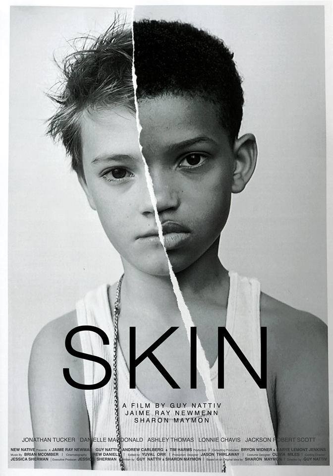 Skin Pictures | Rotten Tomatoes