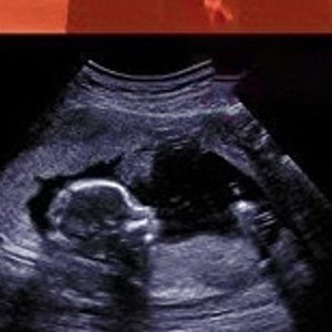 Double Daddy (2015) - Rotten Tomatoes