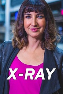 X-Ray - Rotten Tomatoes